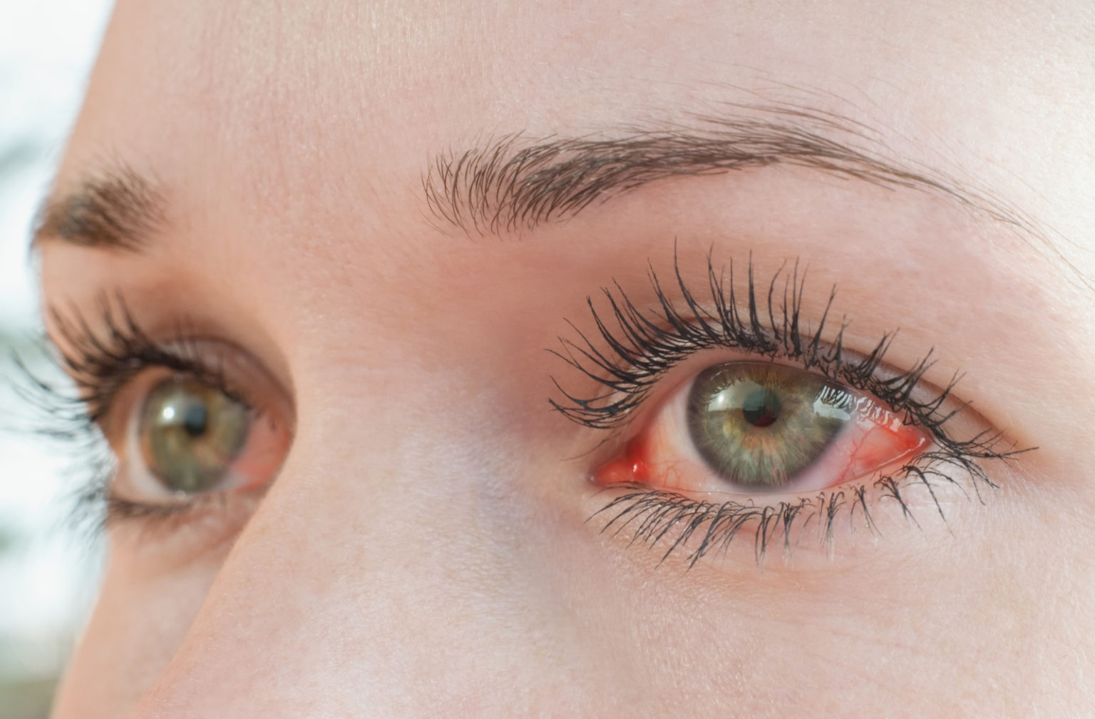 Feeling Pressure In Your Eyes Common Causes Treatments feeling-pressure-in-your-eyes-common-causes-treatments